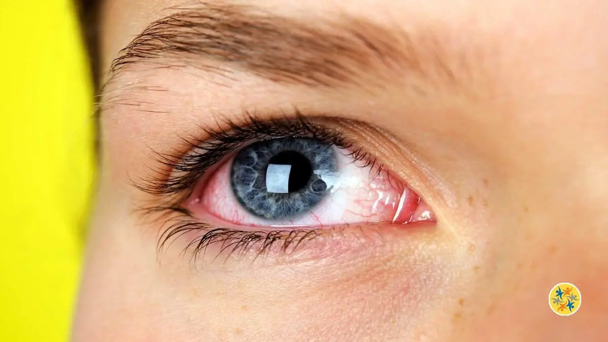 L'Aliment qui Soignera vos Yeux Irrités en un Rien de Temps