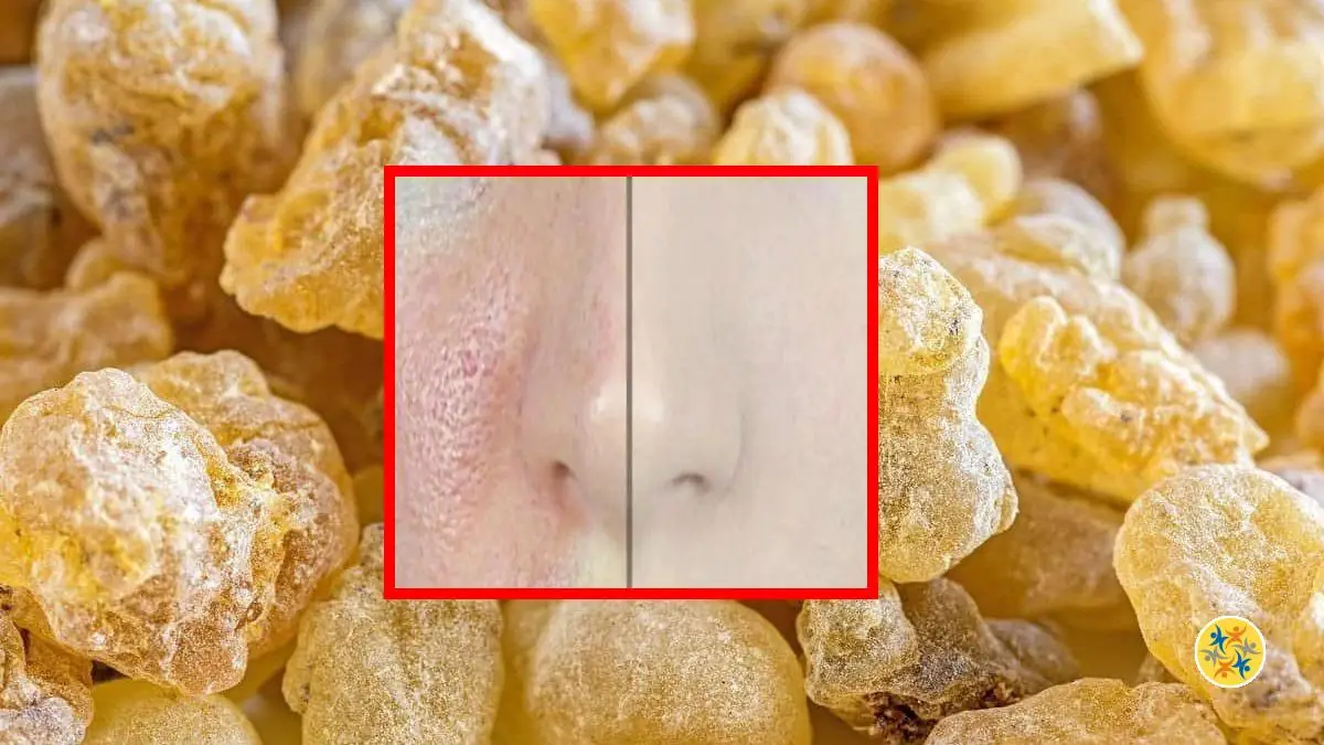 Le Truc d’Encens Amer Pour Eliminer les Rides et les Boutons