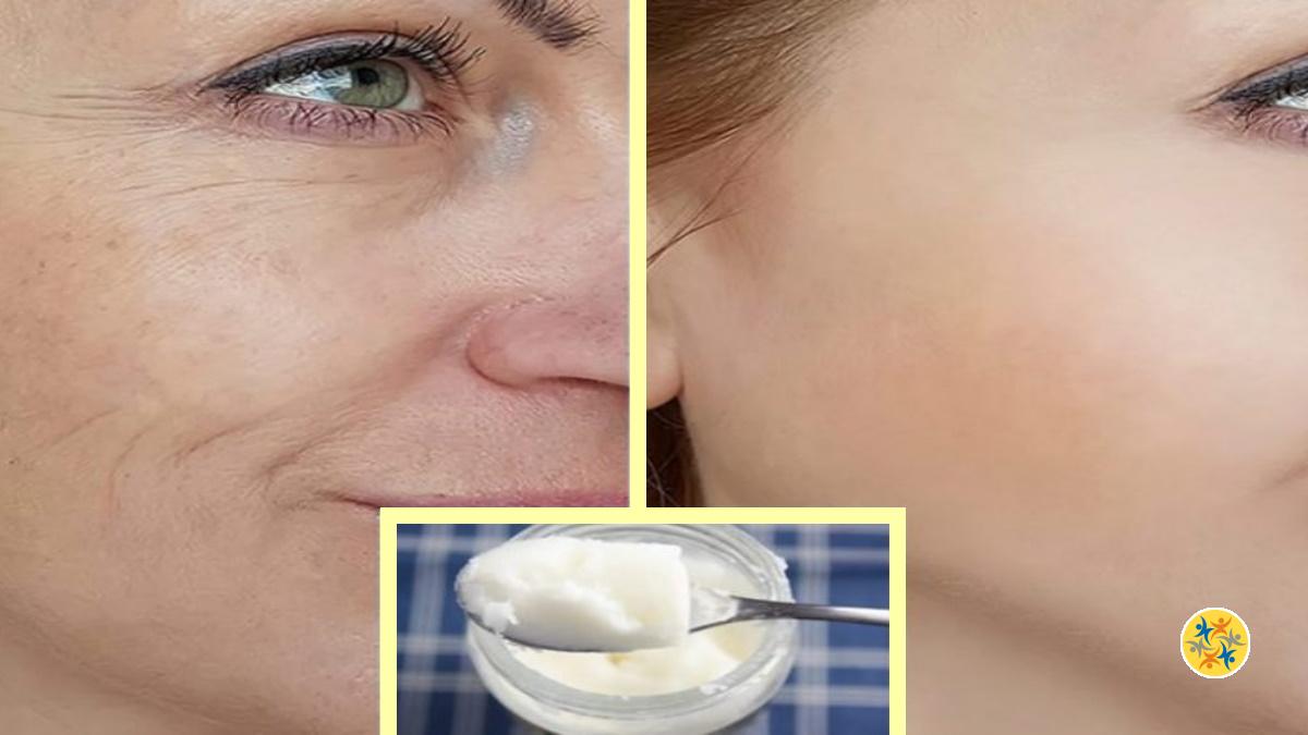 Luttez Contre les Rides Avec 2 Masques à Base d’Huile de Noix de Coco